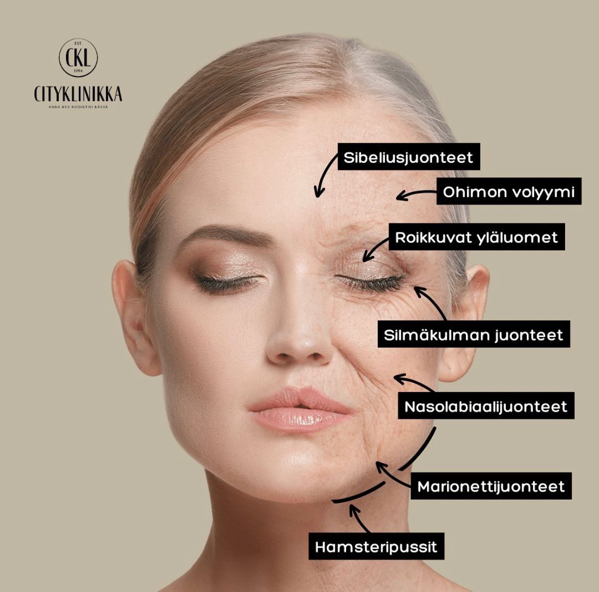 Juonteet ja rypyt – kysymyksiä ja vastauksia | Cityklinikka